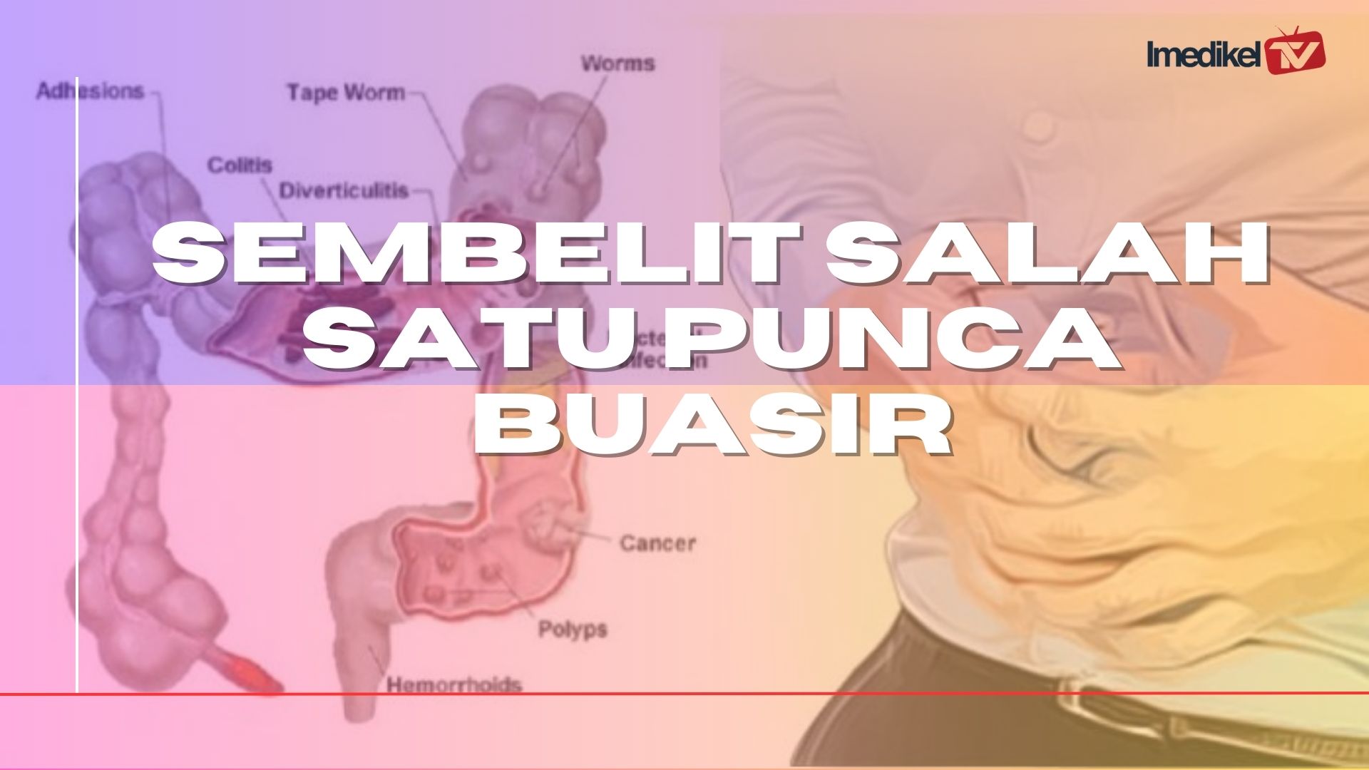 SEMBELIT SALAH SATU PUNCA BUASIR - Imedikel TV